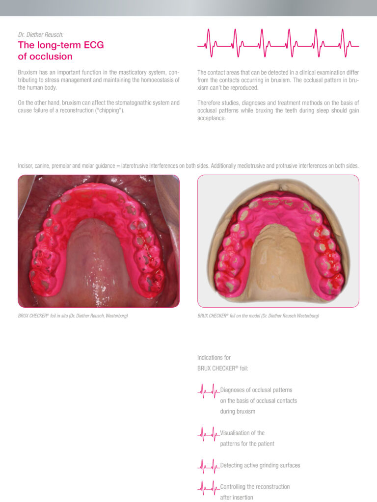 BRUX CHECKER - Dentitalia
